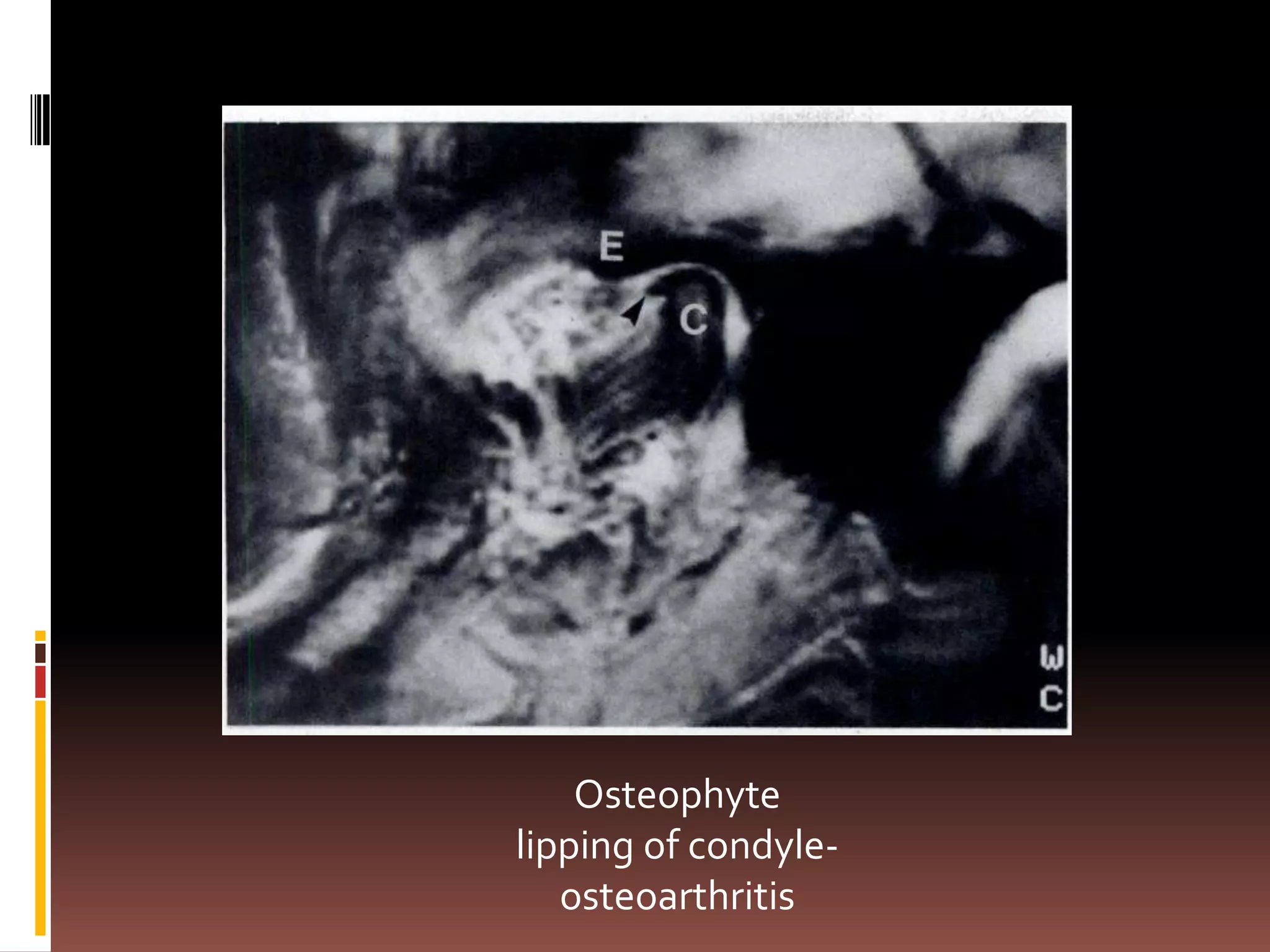 TMJ Imaging | PPTX