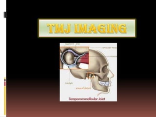 TMJ Imaging | PPTX