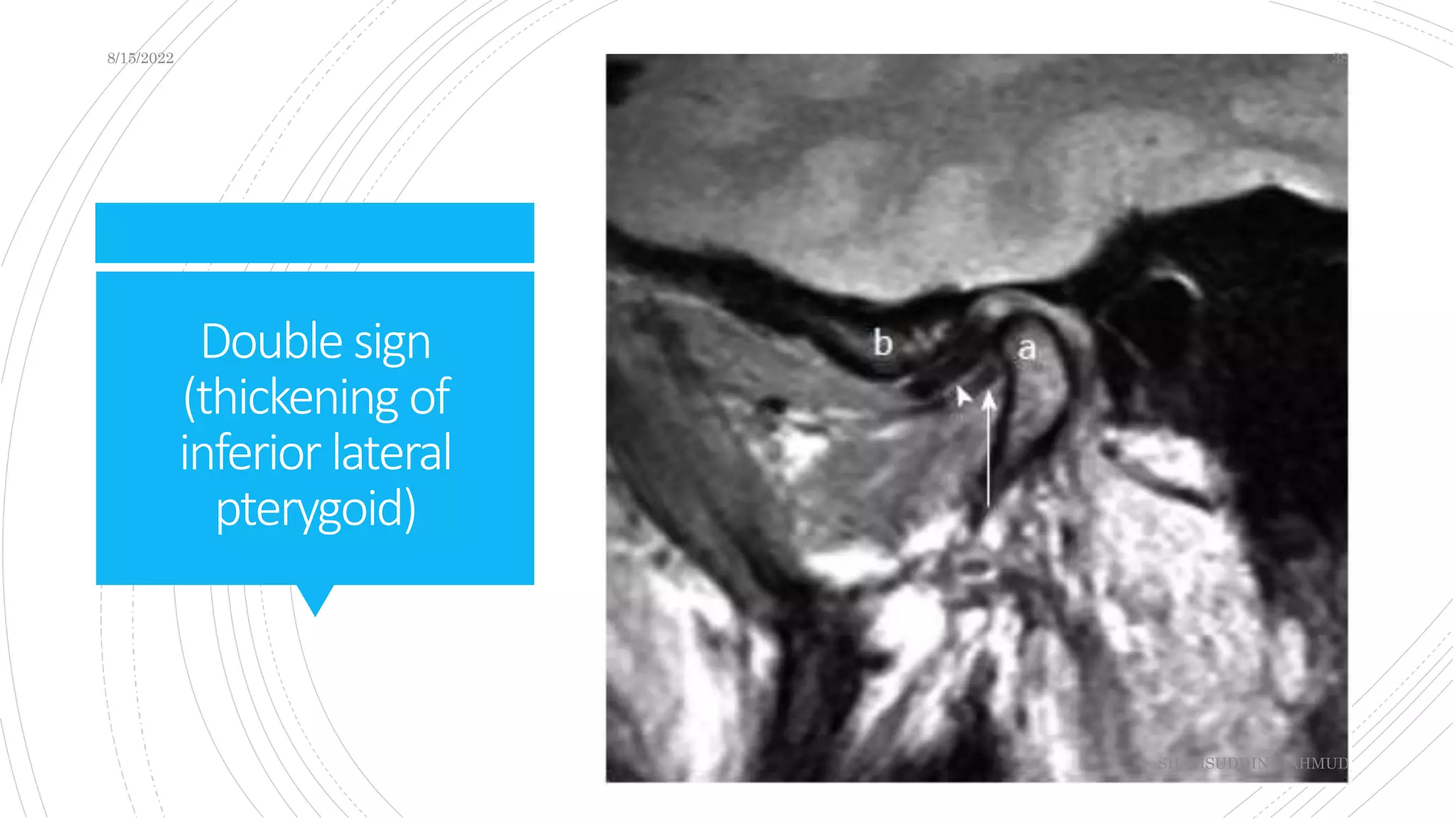 TMJ IMAGING.pptx