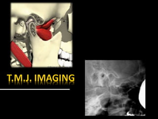 TMJ IMAGING.pptx