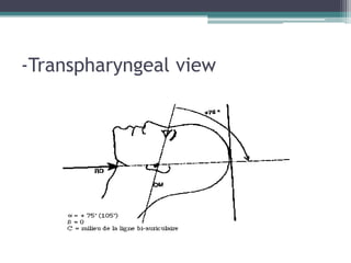 Tmj imaging techniques | PPTX