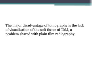 Tmj imaging techniques | PPTX