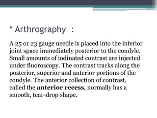 Tmj imaging techniques | PPTX