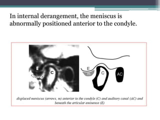 Tmj imaging techniques | PPTX