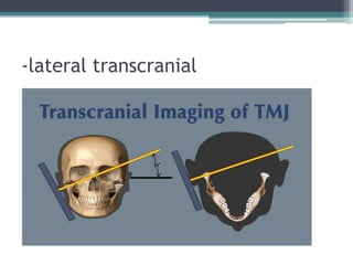 Tmj imaging techniques | PPTX