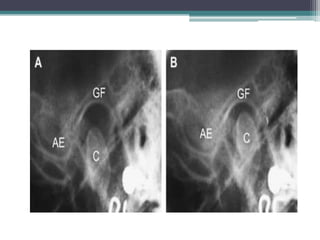 Tmj imaging techniques | PPTX