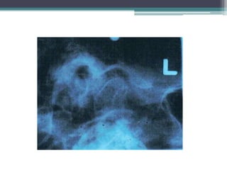 Tmj imaging techniques | PPTX