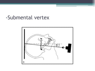 Tmj imaging techniques | PPTX