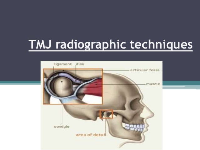 Tmj imaging techniques