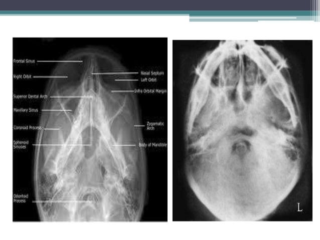 Tmj imaging techniques