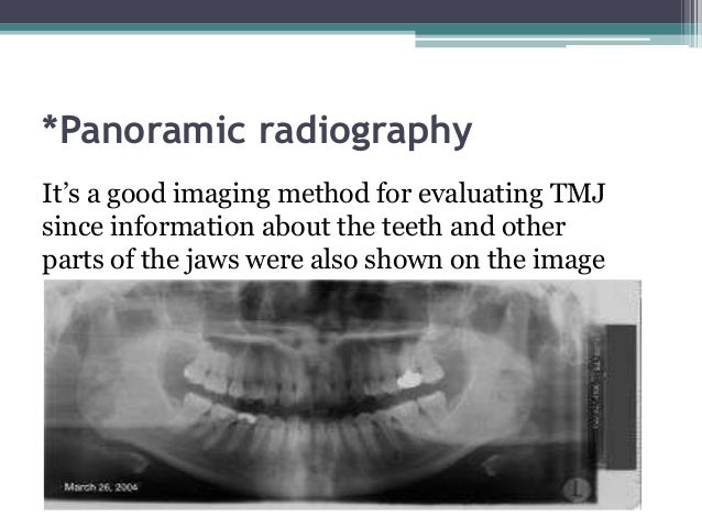 Tmj imaging techniques