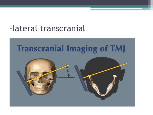 Tmj imaging techniques