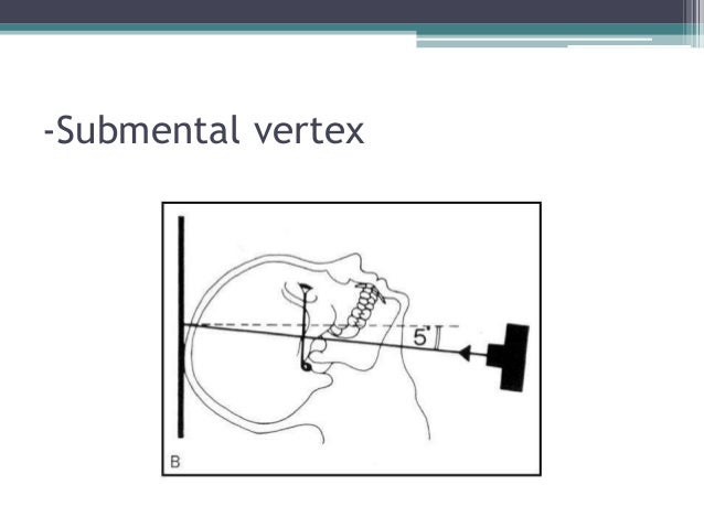 Tmj imaging techniques