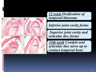 TEMPOROMANDIBULAR JOINT | PPTX