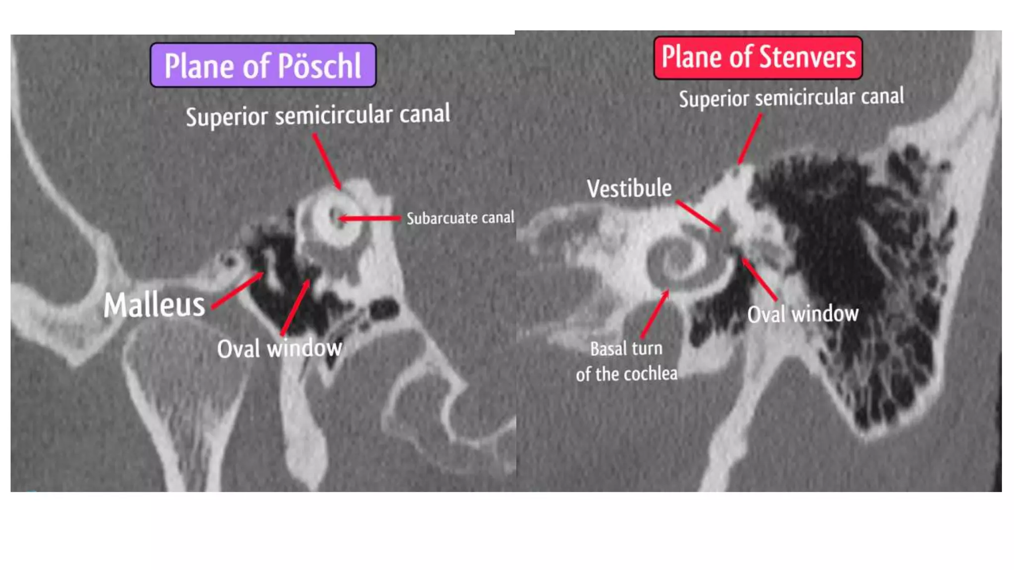 CT Temporomandibularjoints.pptx