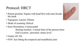 CT Temporomandibularjoints.pptx