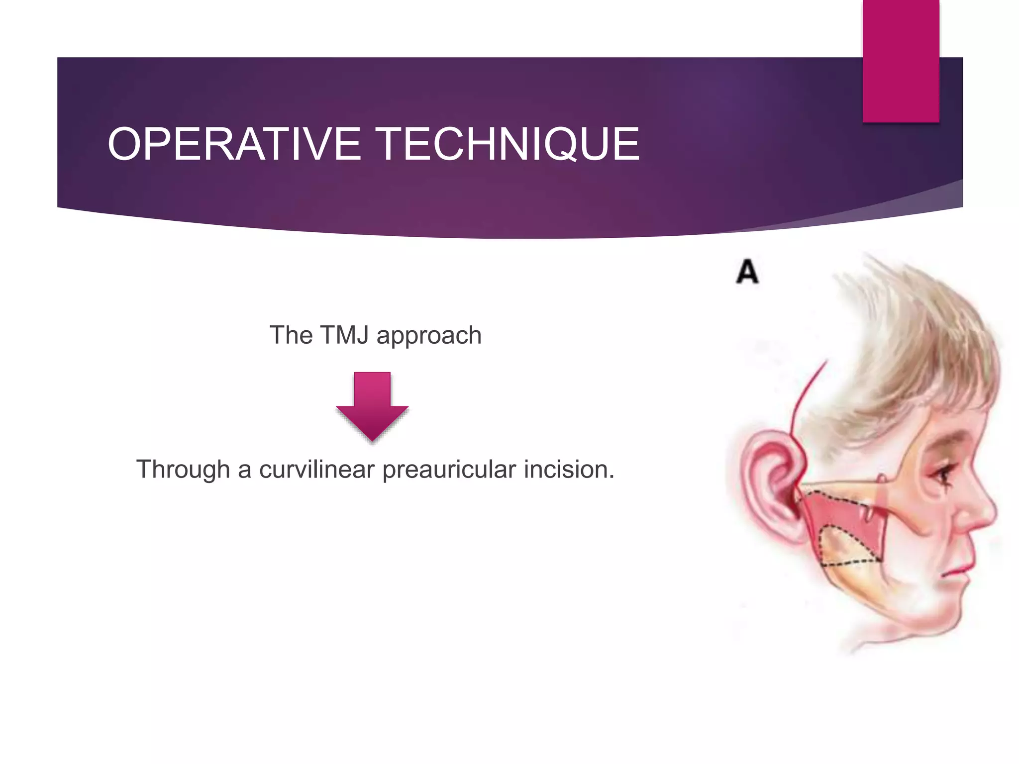 Kaban protocol tmj ankylosis treatment orignal 1990 | PPTX