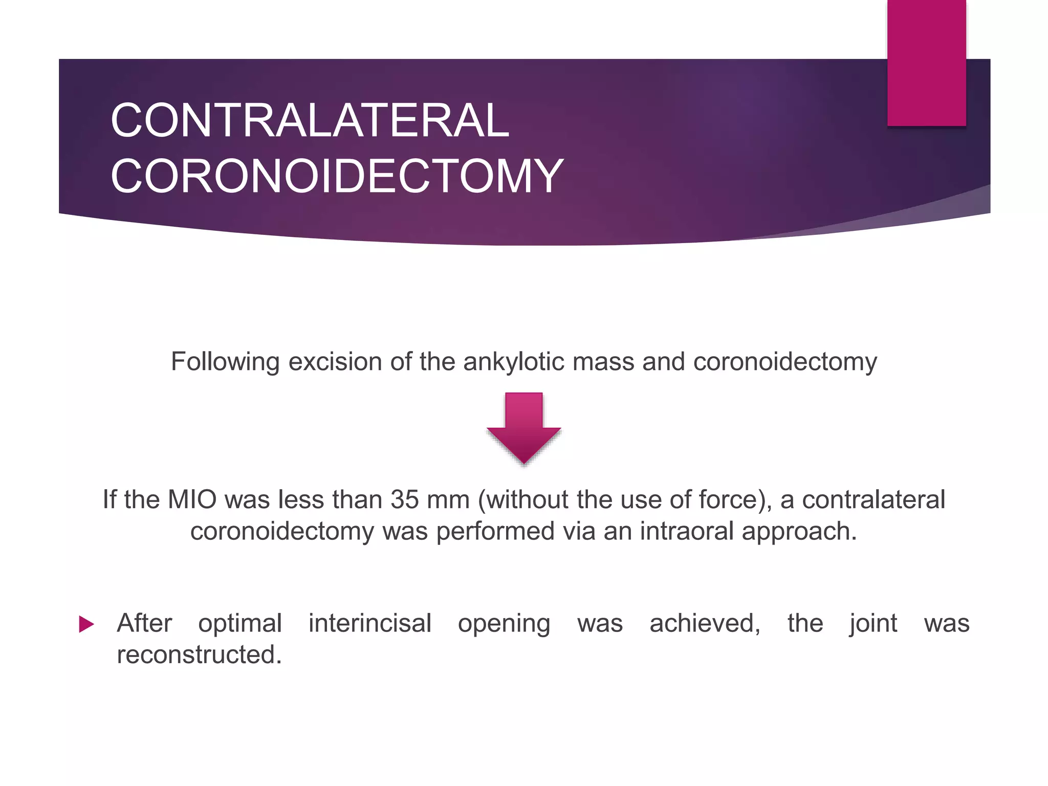 Kaban protocol tmj ankylosis treatment orignal 1990 | PPTX