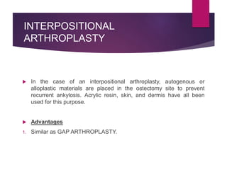 Kaban protocol tmj ankylosis treatment orignal 1990 | PPTX