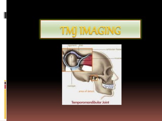 Tmj joint imaging | PPTX