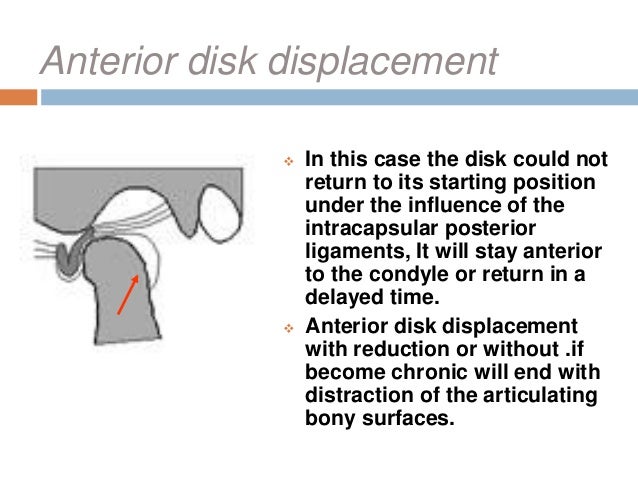 Tmj disorders