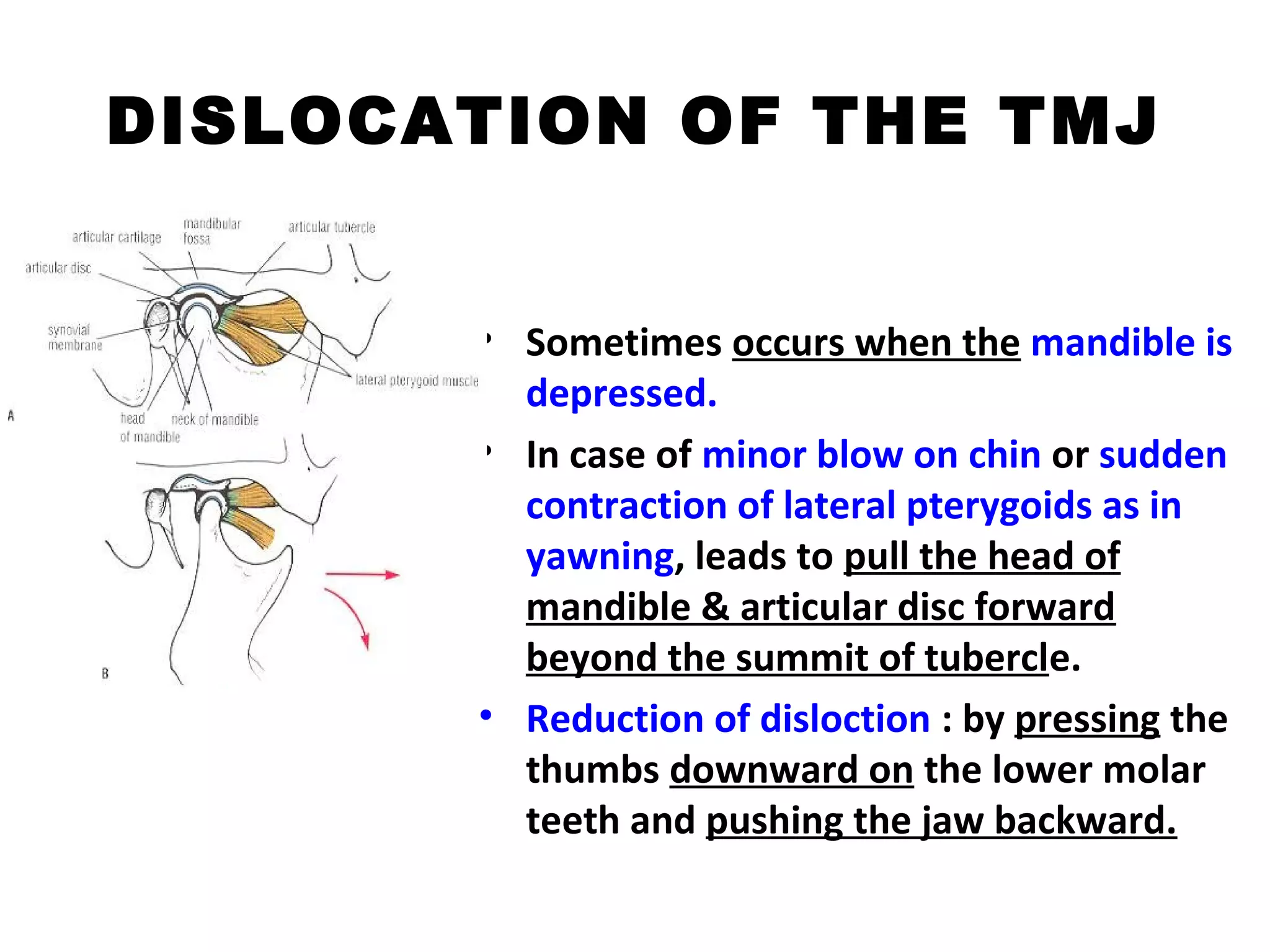 MUSCLES OF MASTICATION & TEMPOROMANDIBULAR JOINT | PPT