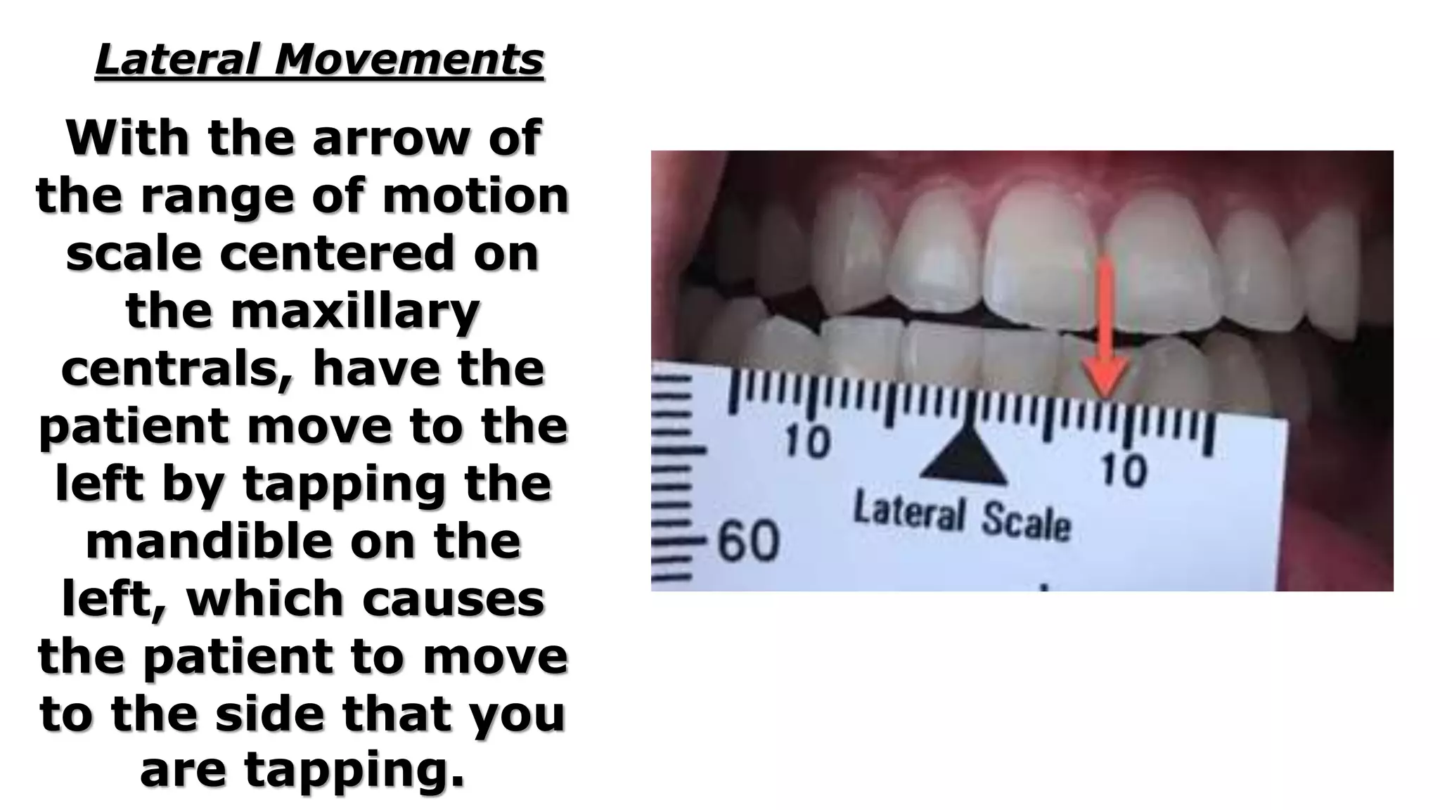 TMJ MOTION MEASUREMENTS | PPTX