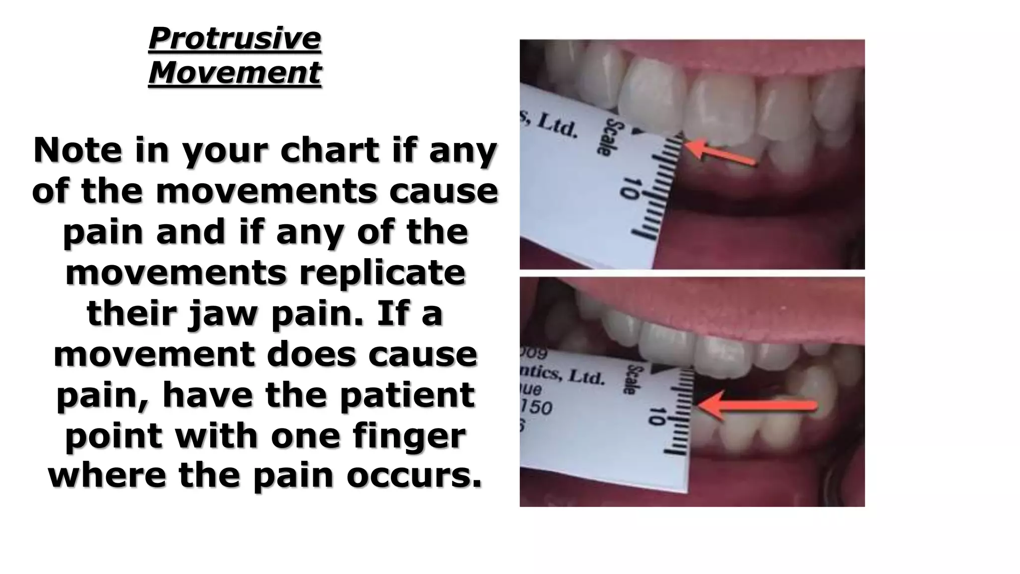 TMJ MOTION MEASUREMENTS | PPTX