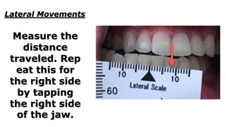TMJ MOTION MEASUREMENTS | PPTX