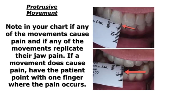 TMJ MOTION MEASUREMENTS | PPTX
