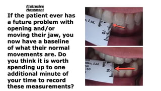 TMJ MOTION MEASUREMENTS | PPTX