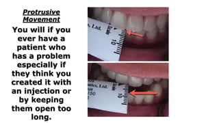 TMJ MOTION MEASUREMENTS | PPTX