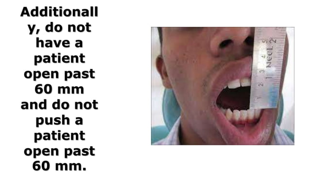 TMJ MOTION MEASUREMENTS | PPTX