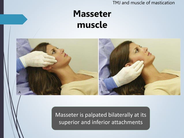 Temporomandibular joint Muscles of Mastication | PPT