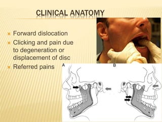 Tm joint, mandibular nerve | PPTX | Death, Injury, or Military Conflict ...
