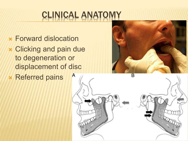 Tm joint, mandibular nerve | PPT