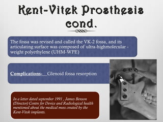 Tmj reconstruction | PPT