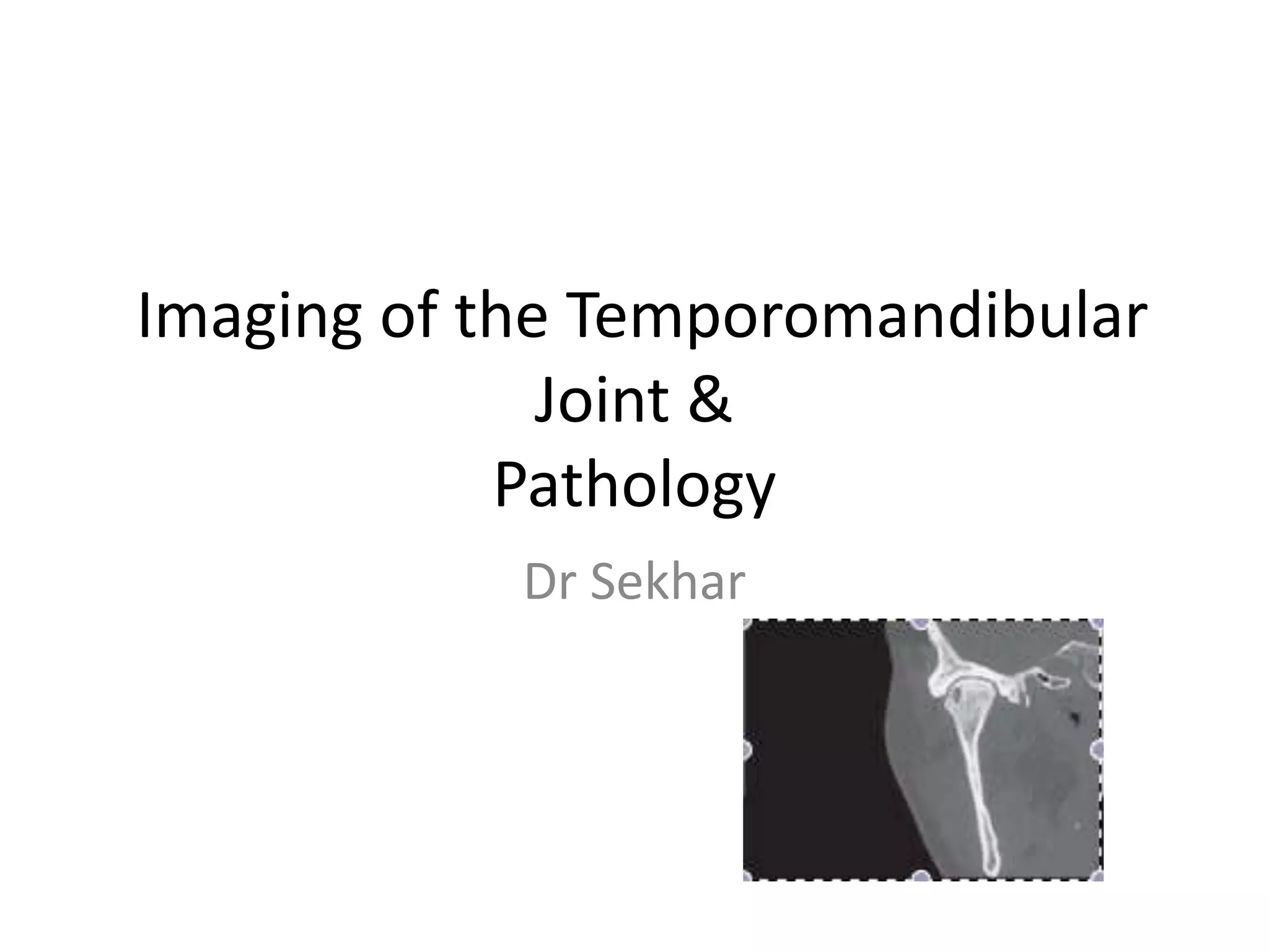 Tmj pathology | PPTX