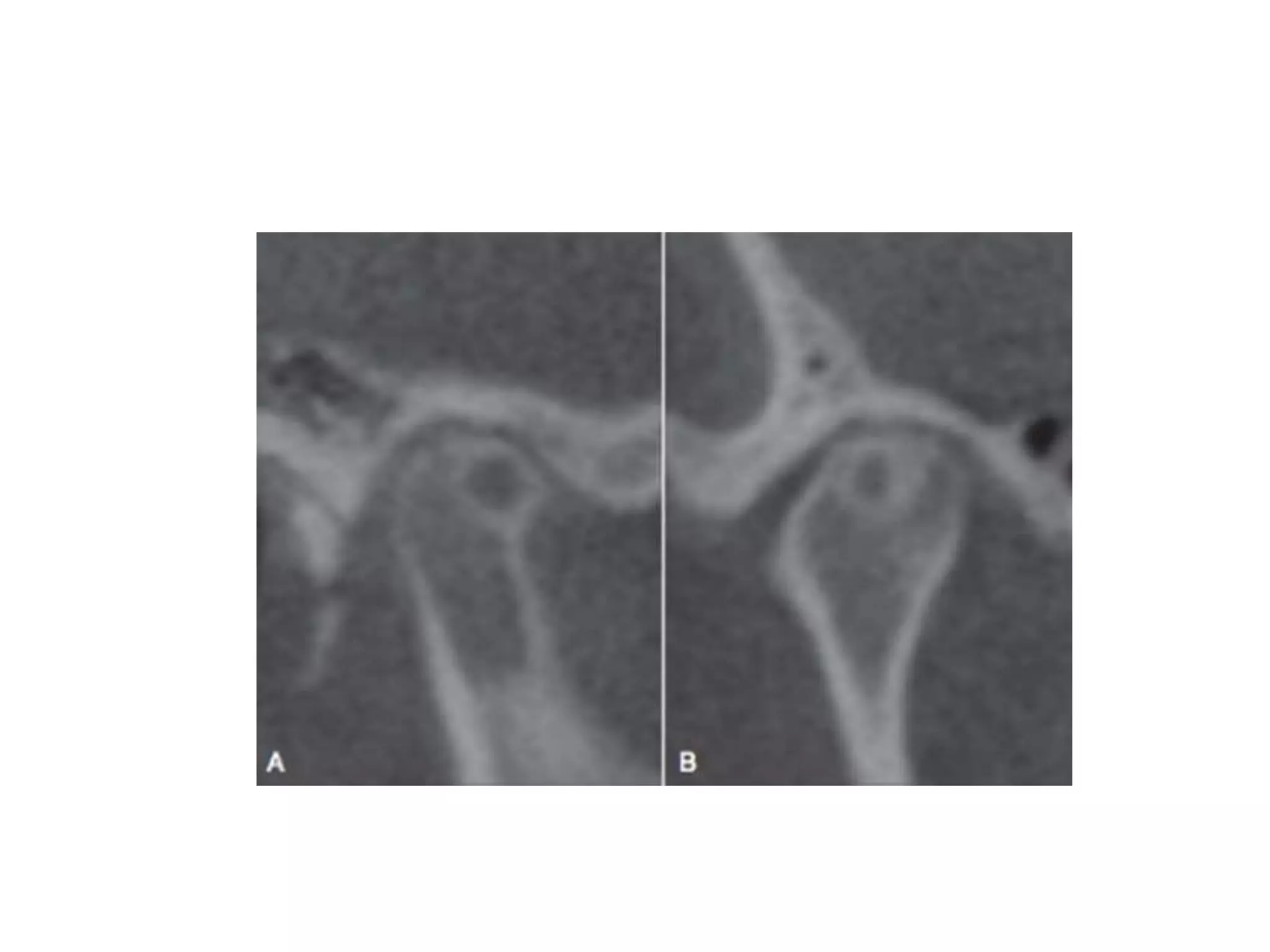 Tmj pathology | PPTX