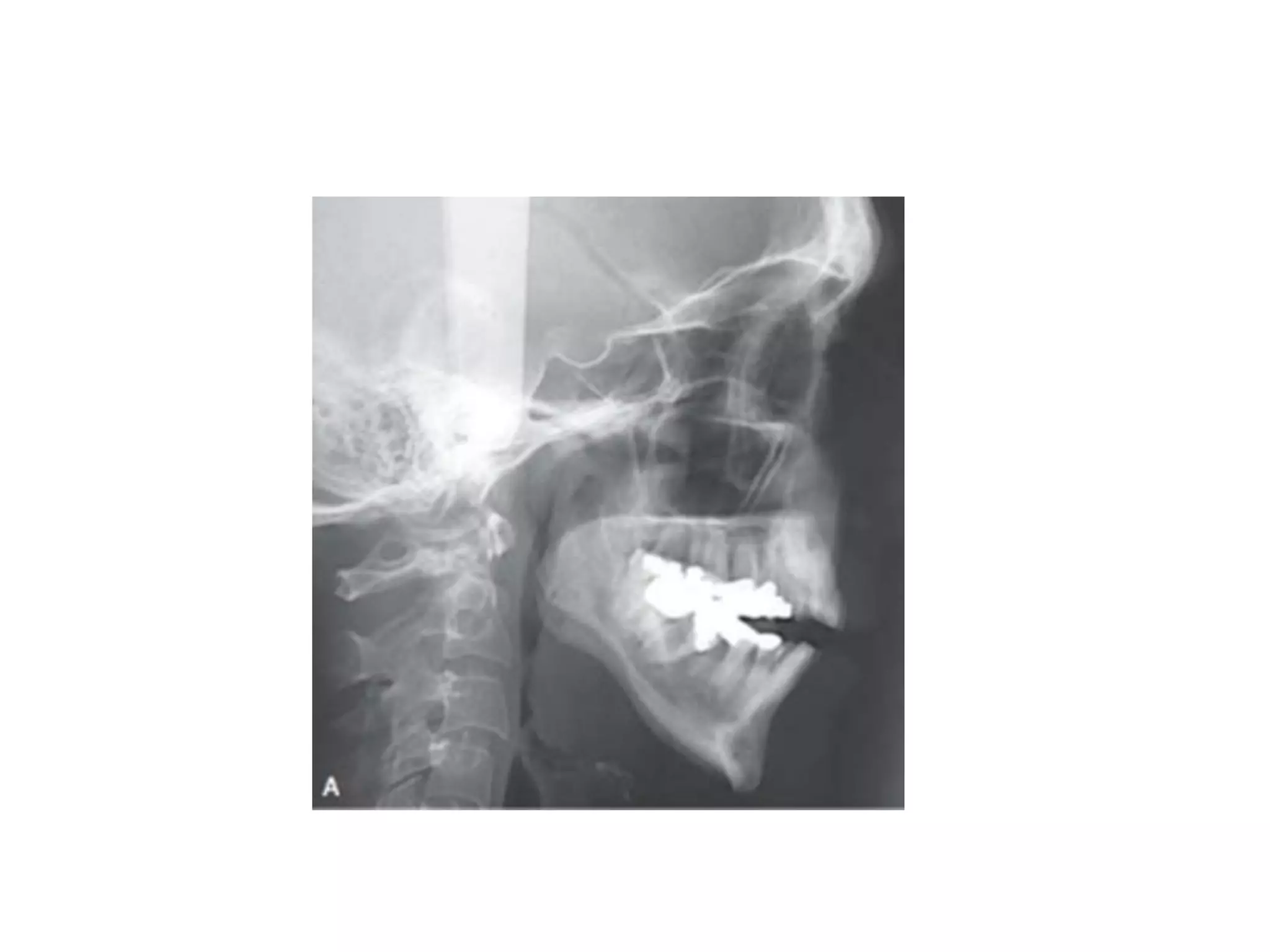 Tmj pathology | PPTX