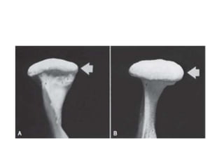 Tmj pathology | PPTX