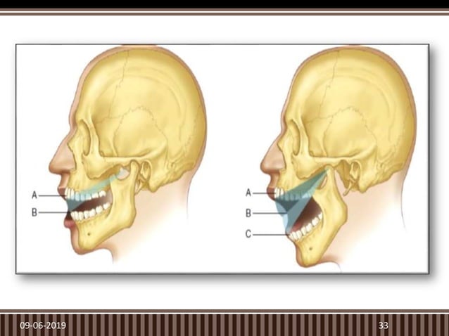 TMJ and Its Applied Aspects in Prosthodontics | PPTX