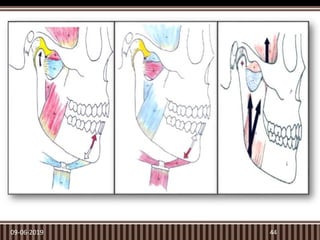 TMJ and Its Applied Aspects in Prosthodontics | PPTX
