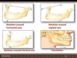 TMJ and Its Applied Aspects in Prosthodontics | PPTX