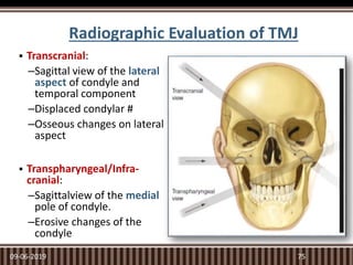 TMJ and Its Applied Aspects in Prosthodontics | PPTX