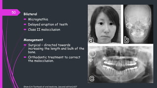 OCCLUSION AND TMDs | PPTX