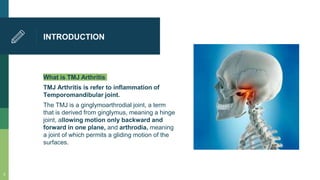 TMJ Arthritis | PPTX