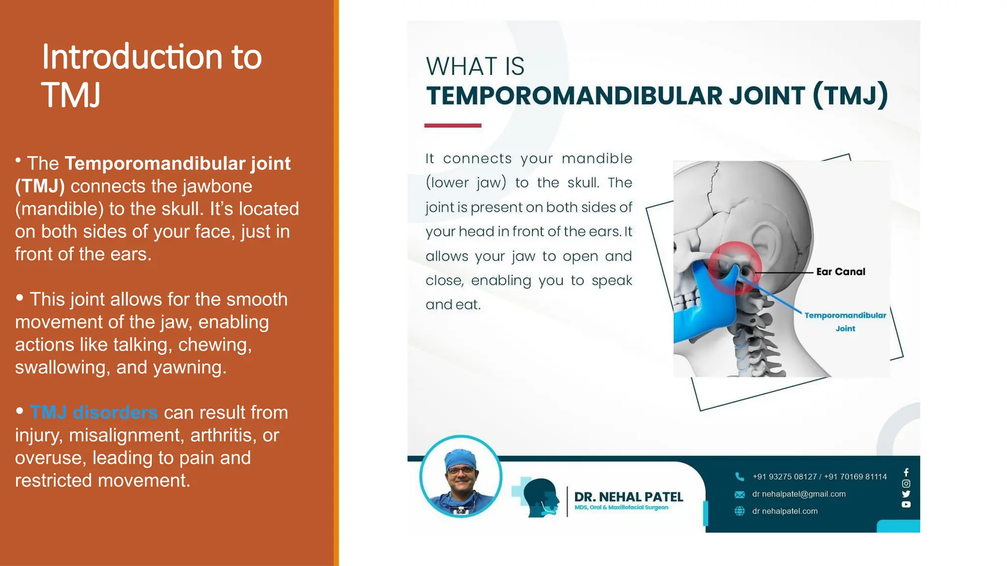 Difference between TMJ subluxation and dislocation. pptx | PPTX