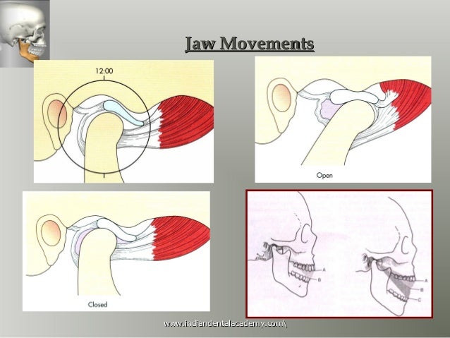 Tmj surgical anatomy and approaches (nx power lite) /certified fixed