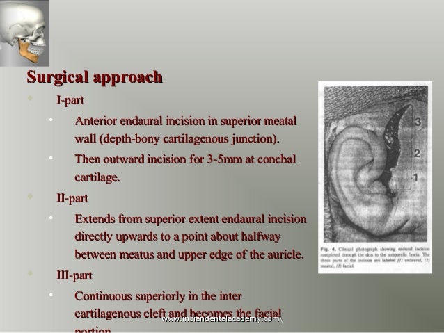 Tmj surgical anatomy and approaches (nx power lite) /certified fixed